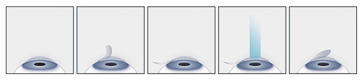 Lasik in NYC | Eye Surgery Specialist & Treatment | Manhattan Eye