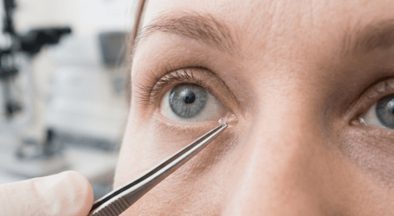 Punctal Plug Procedure: What to Expect Before, During, and After ...